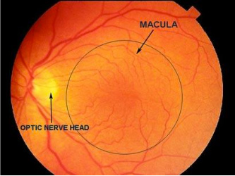 Retinofotografía retinal – Dr. Michel Mehech Hirane
